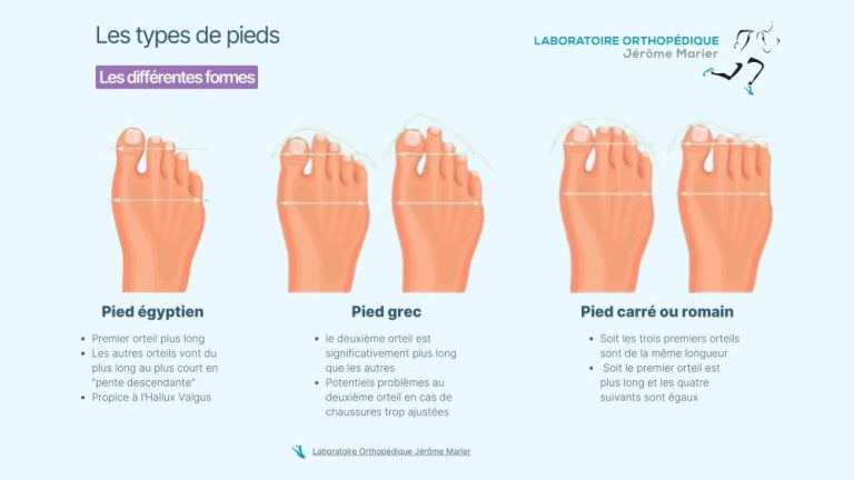 Quels sont les différents types de pieds? | Anatomie du pied humain